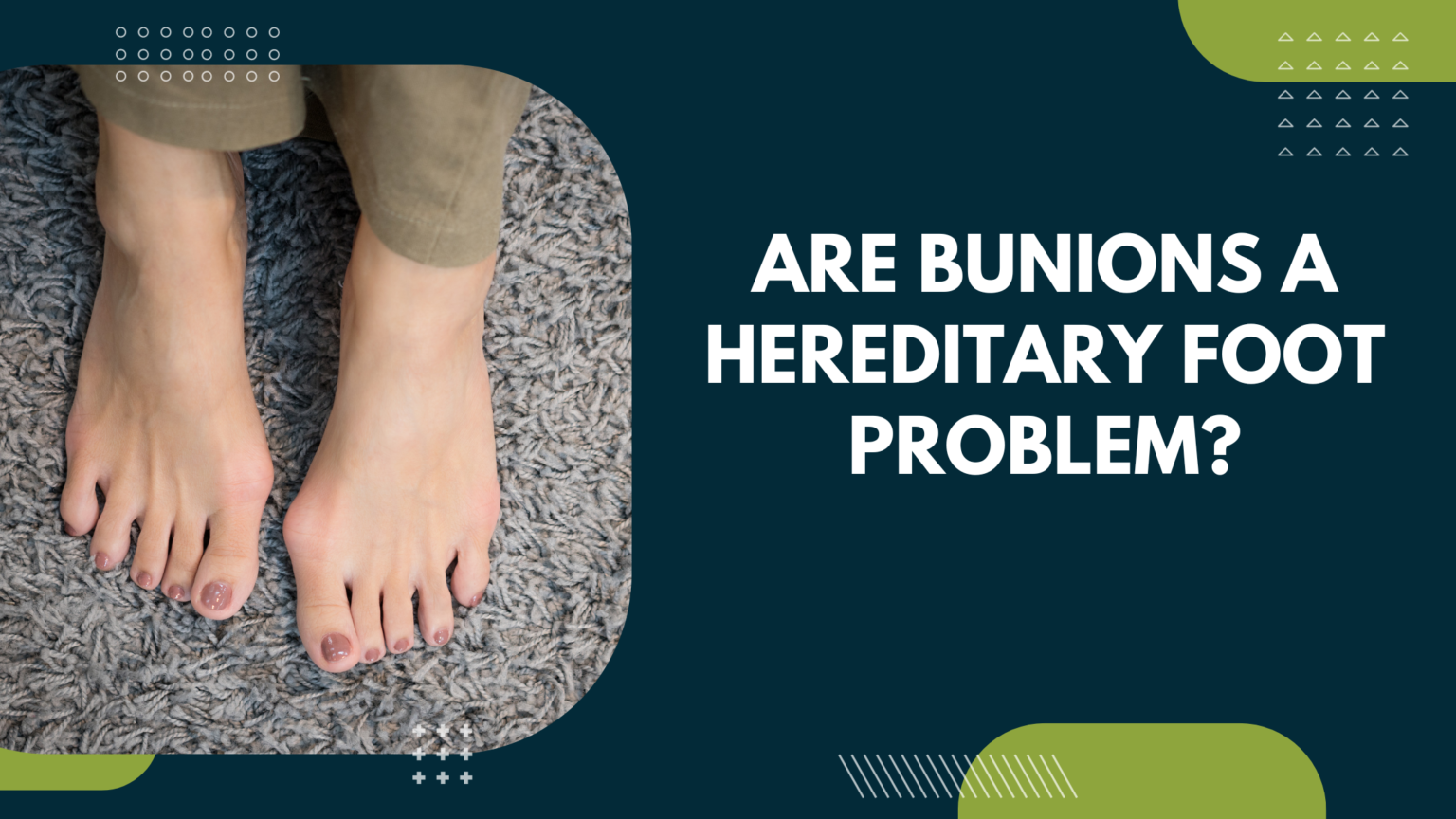 Are Bunions a Hereditary Foot Problem? - Dr KP Meda