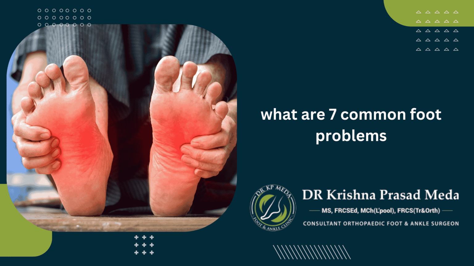 What are 7 common foot problems